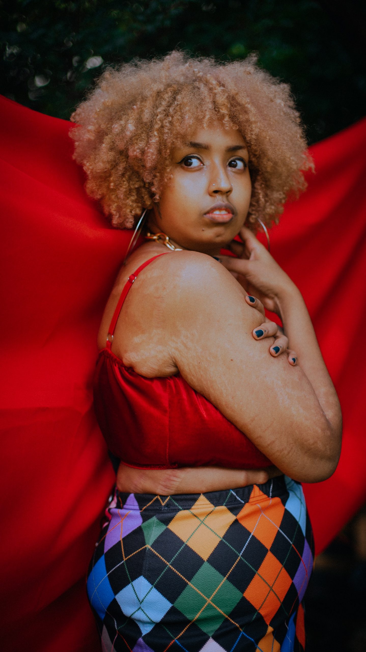 Why Do I Have Stretch Marks? | Hidden Strength